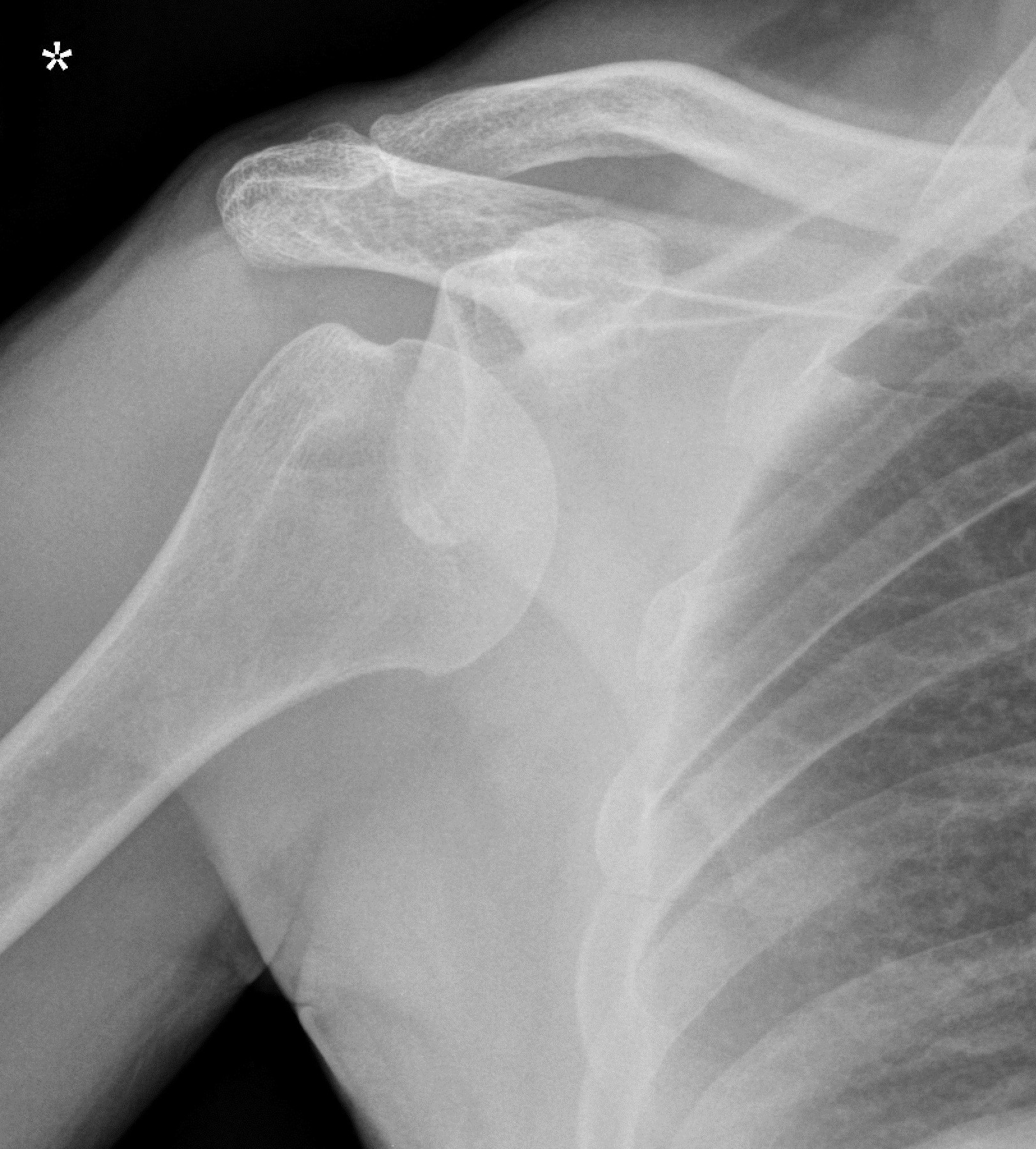 WHAT WE DO – Derby Shoulder Unit